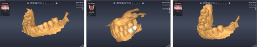 Dentiq Guide for Clinic | Ciデジタルソリューション